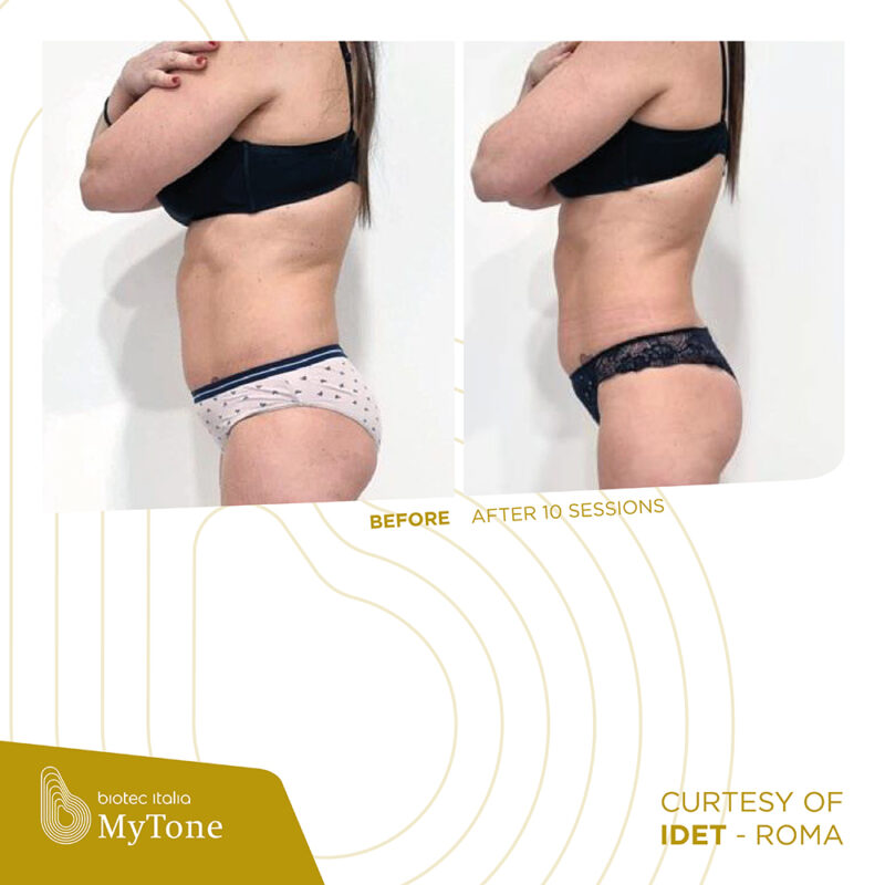 MyTone - Biotec Italia