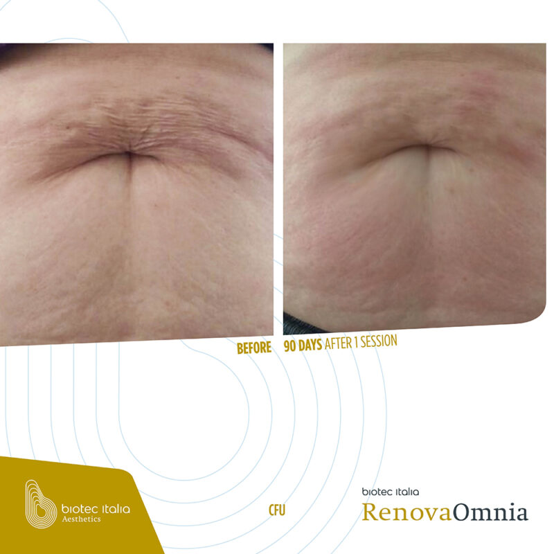 Renova Omnia - Biotec Italia