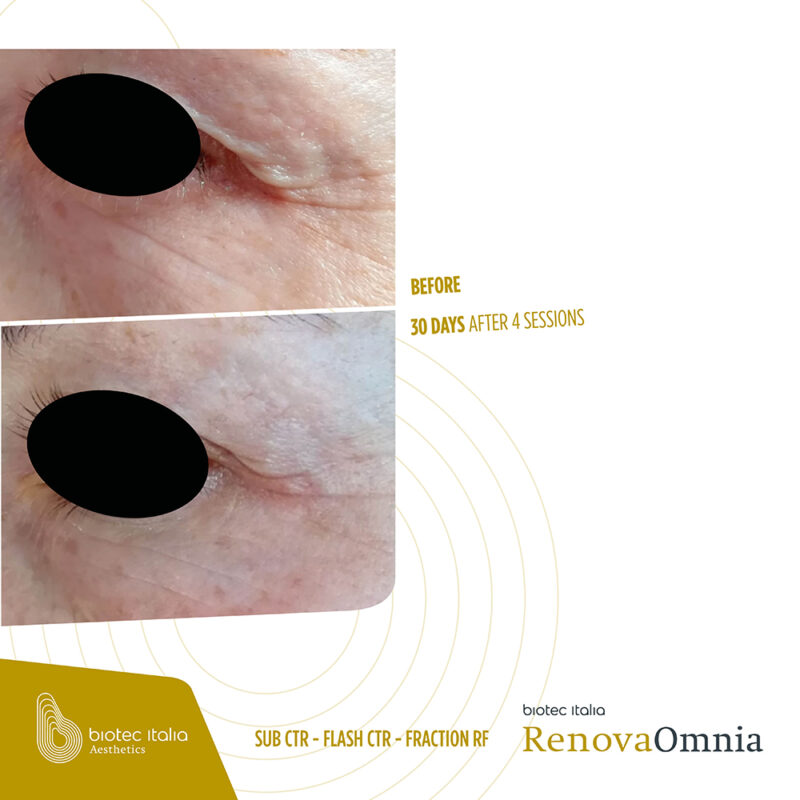 Renova Omnia - Biotec Italia