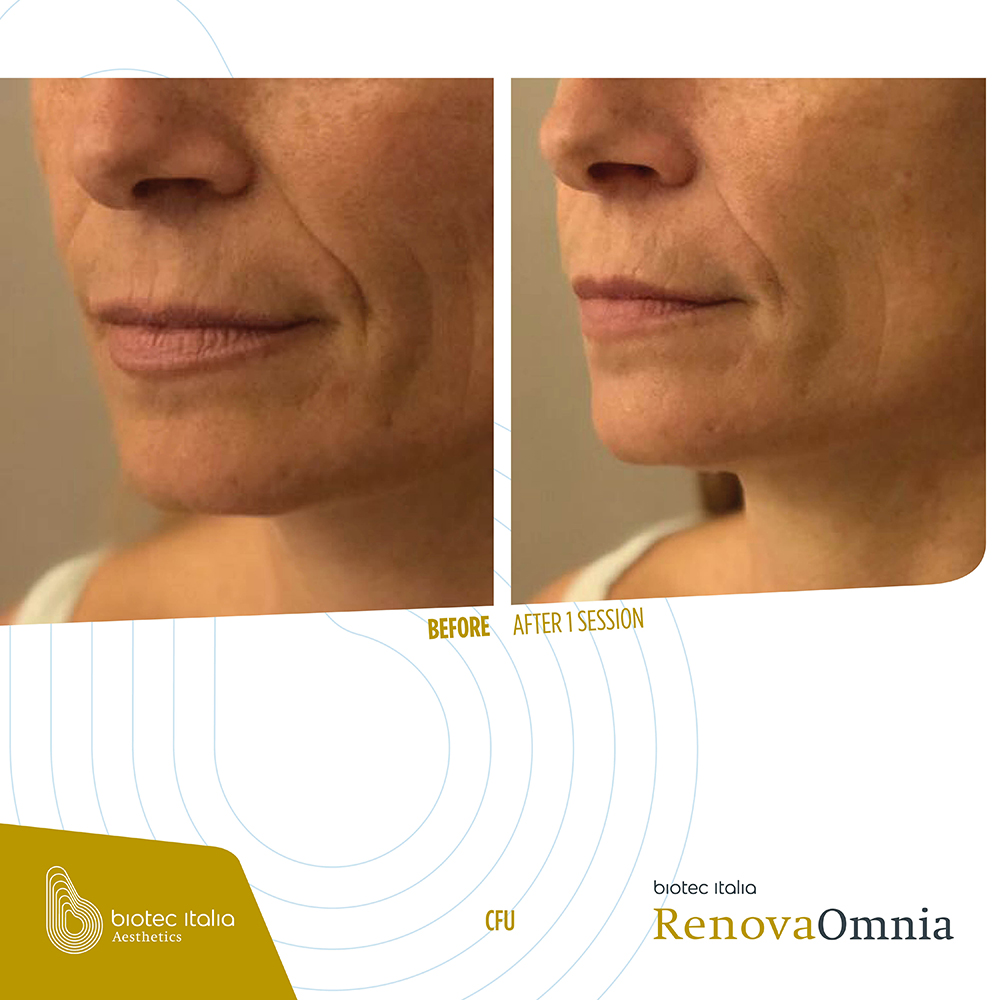 Renova Omnia - Biotec Italia