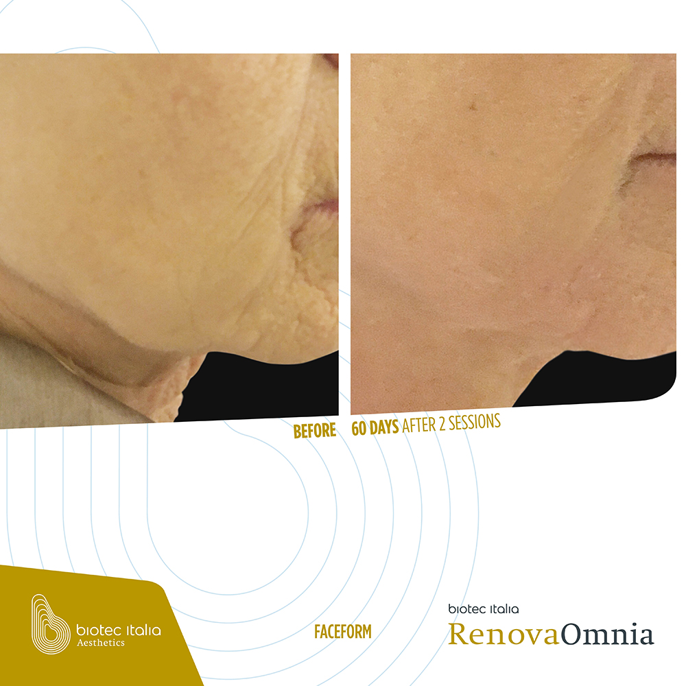 Renova Omnia - Biotec Italia