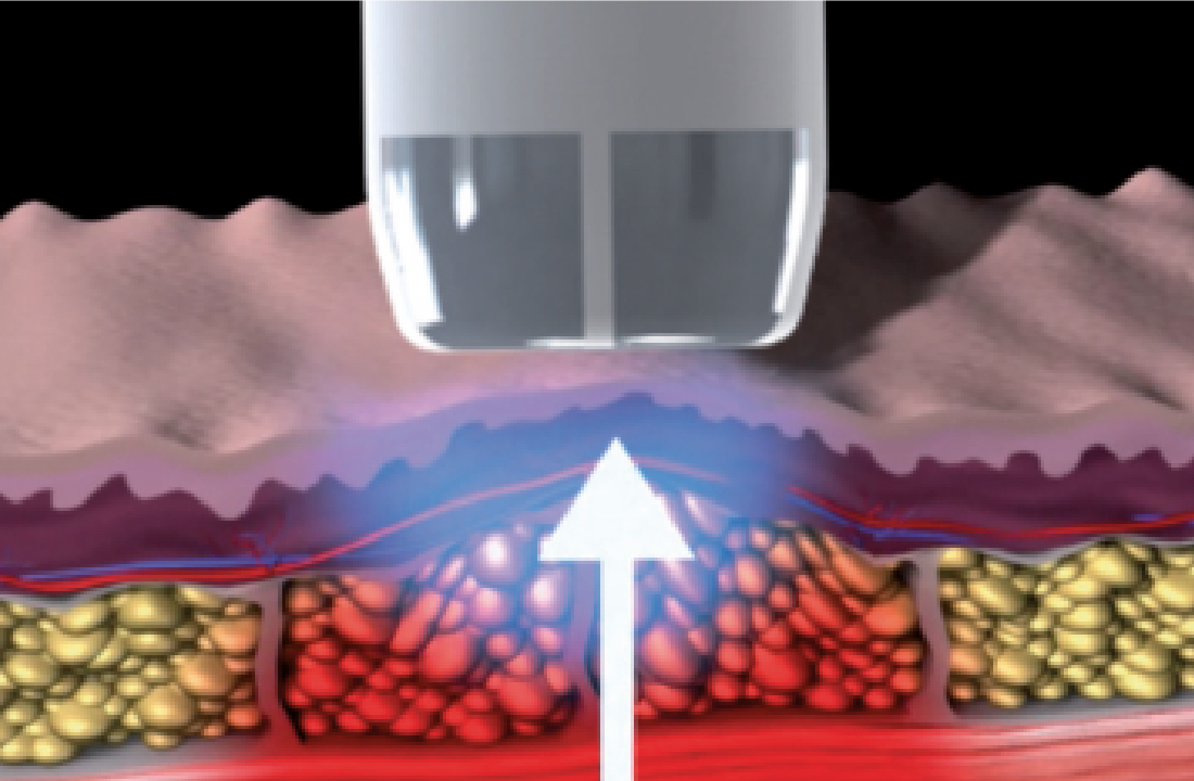 TECHNICAL SPECIFICATIONS AND FOCUS ON THE TECHNOLOGY - Biotec Italia