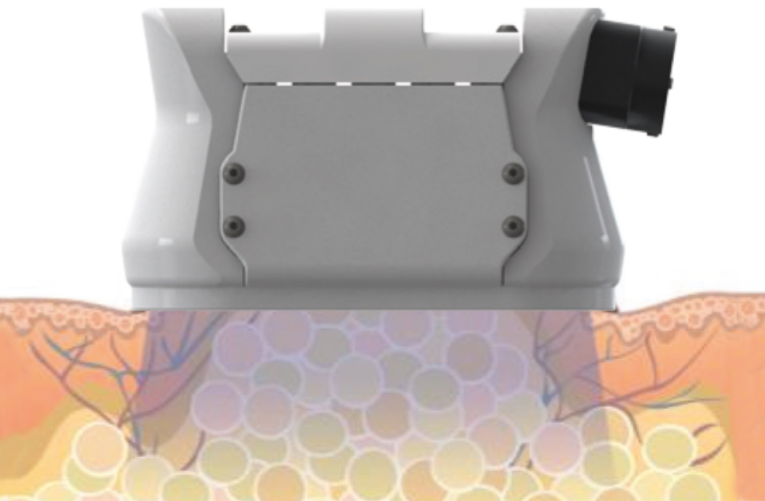 TECHNICAL SPECIFICATIONS AND FOCUS ON THE TECHNOLOGY - Biotec Italia