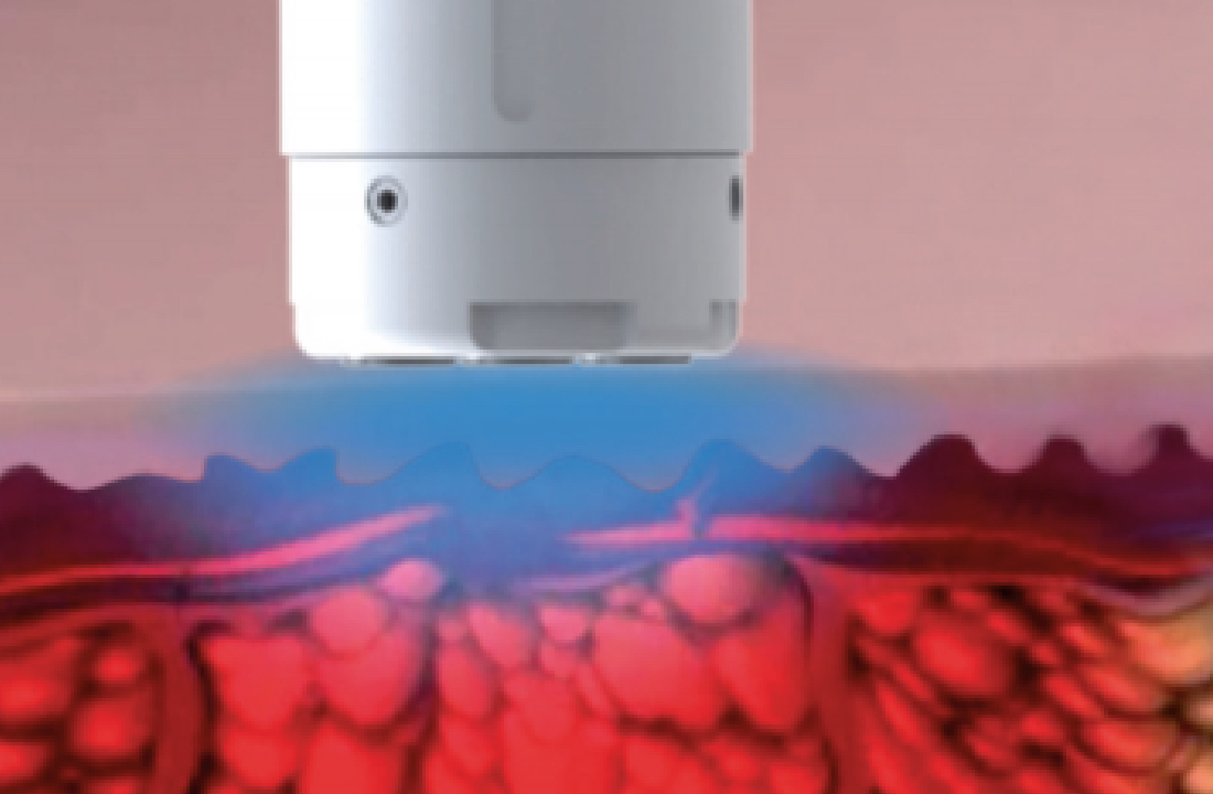 TECHNICAL SPECIFICATIONS AND FOCUS ON THE TECHNOLOGY - Biotec Italia