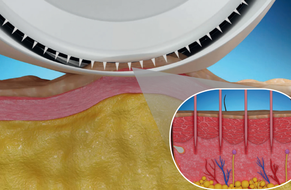 TECHNICAL SPECIFICATIONS AND FOCUS ON THE TECHNOLOGY - Biotec Italia