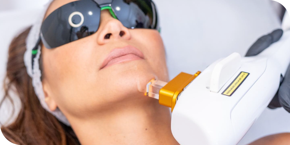 Xlase Plus e il manipolo CPL per le macchie cutanee - Biotec Italia