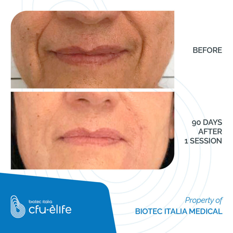 CFU Èlife - Biotec Italia