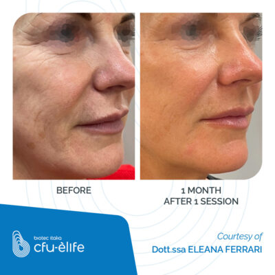 CFU Èlife - Biotec Italia