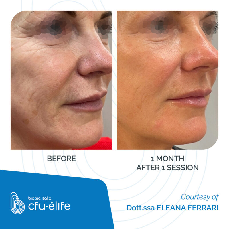 CFU Èlife - Biotec Italia