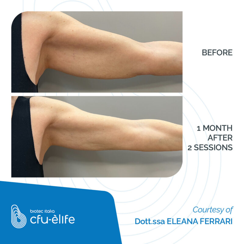 CFU Èlife - Biotec Italia