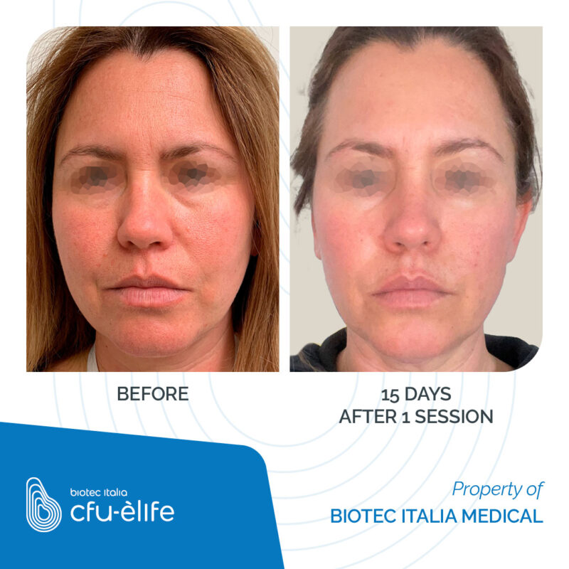 CFU Èlife - Biotec Italia