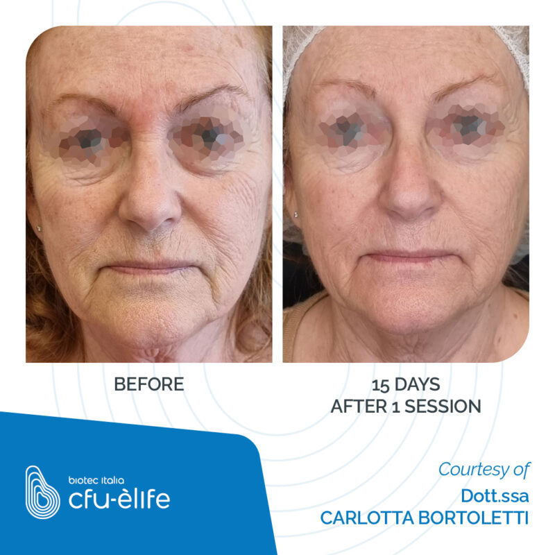 CFU Èlife - Biotec Italia