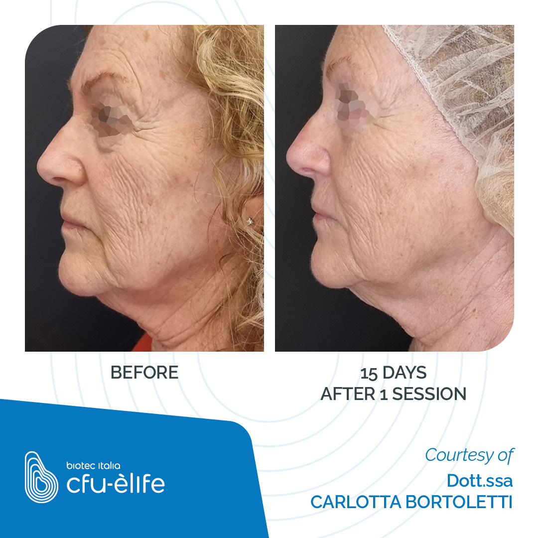 CFU Èlife - Biotec Italia