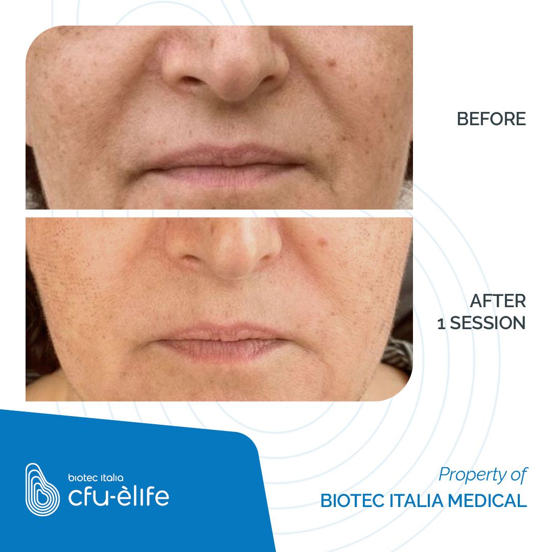 CFU Èlife - Biotec Italia