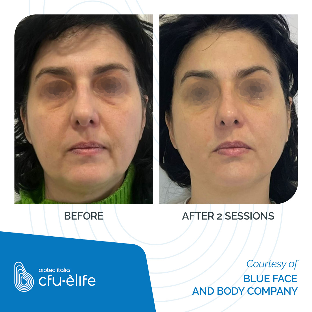 CFU Èlife - Biotec Italia