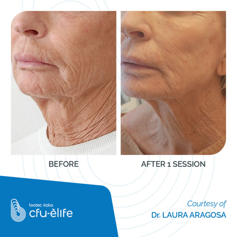 CFU Èlife - Biotec Italia