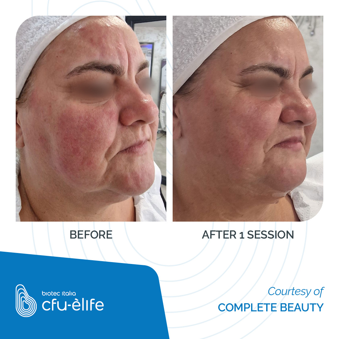 CFU Èlife - Biotec Italia