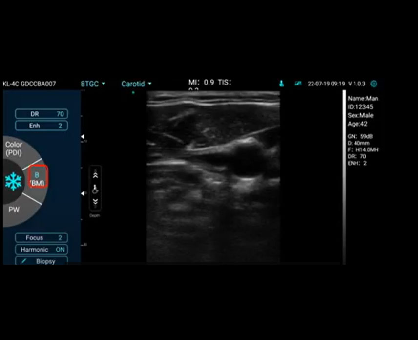 Inskin Vision Handheld-Ultraschall - Biotec Italia