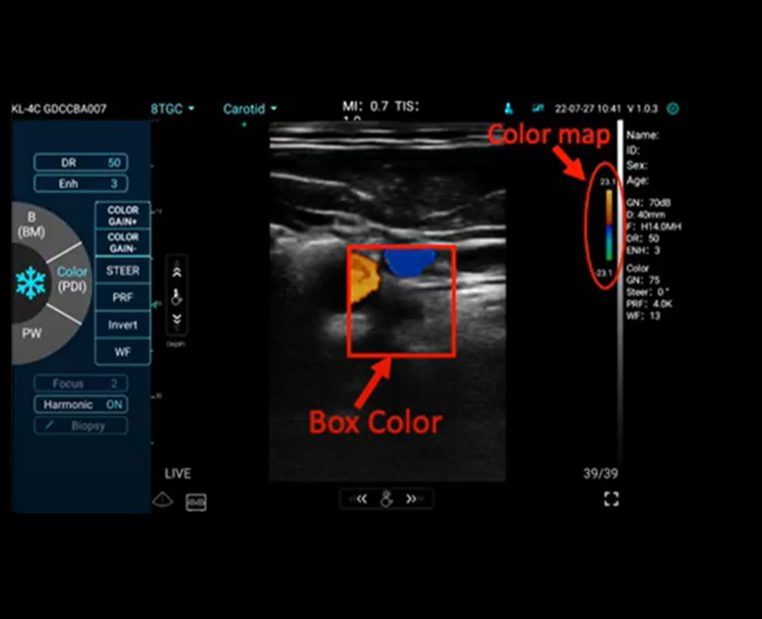 Inskin Vision Handheld Ultrasound Scanner - Biotec Italia