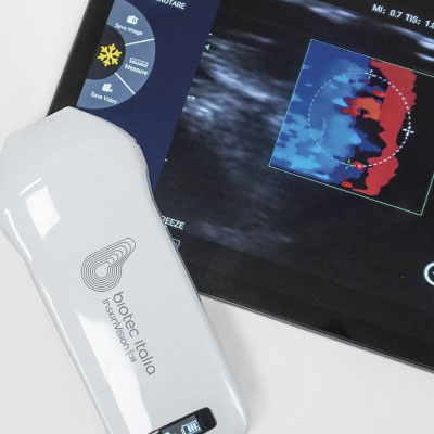 The handheld ultrasound device InskinVision is transforming the world ...