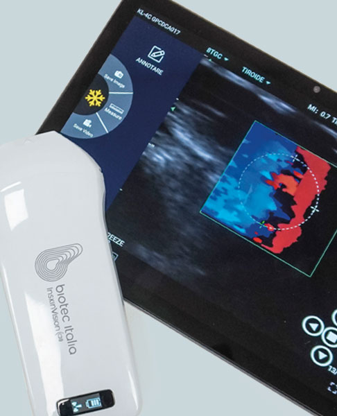 InskinVision - Biotec Italia