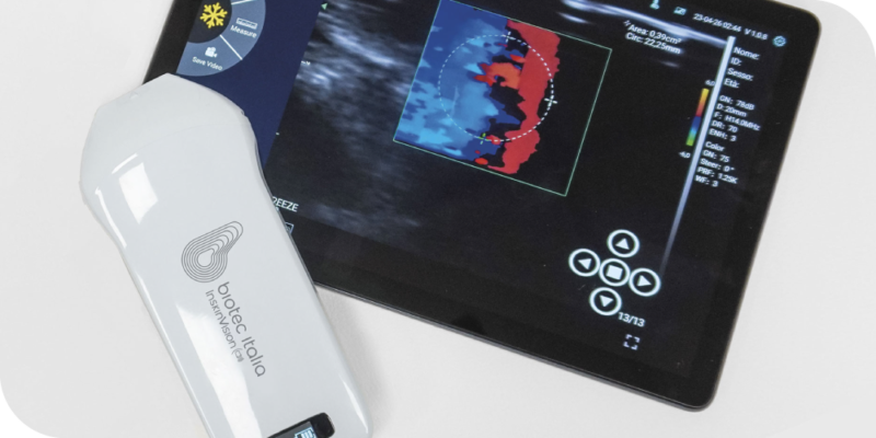 The handheld ultrasound device InskinVision is transforming the world ...