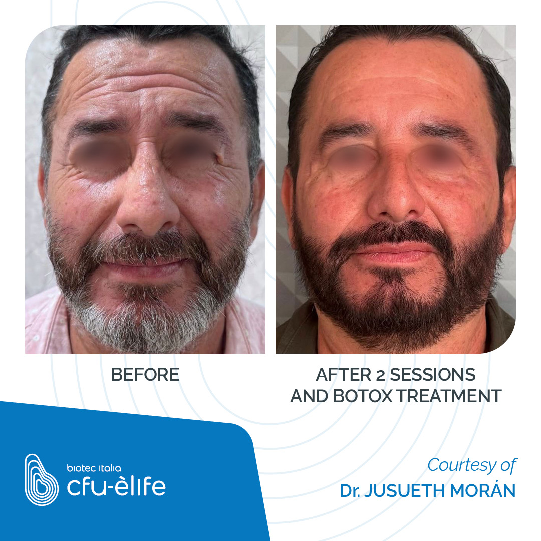 CFU Èlife - Biotec Italia